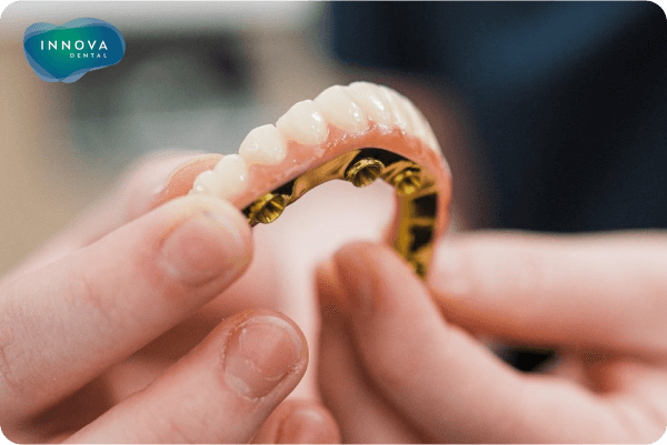 Dental Implants Services at Innova Dental